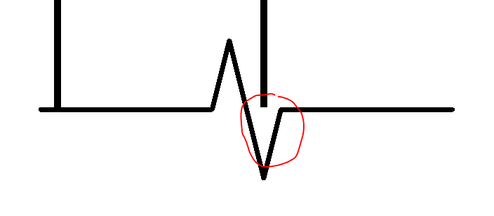 How to make an annotation symbol fuction in a breakline detail element ...