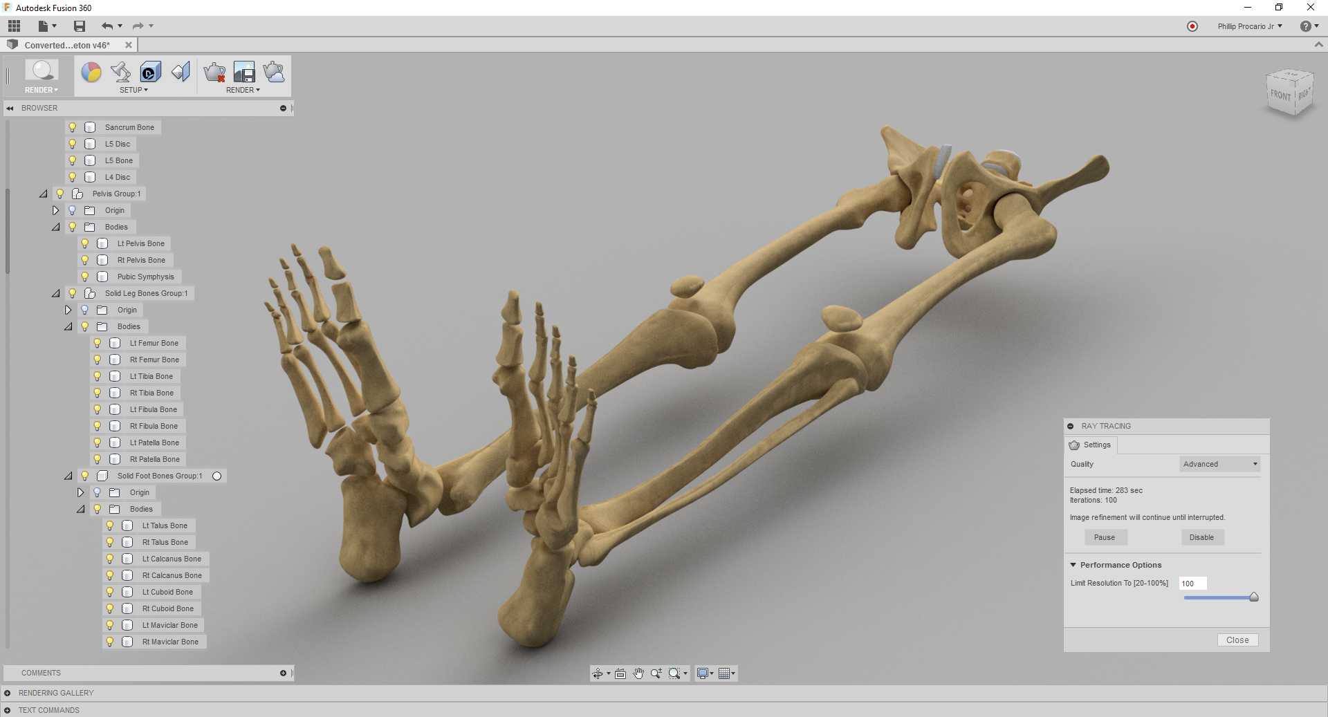Solved: What is really possible with T-Splines..... - Autodesk Community