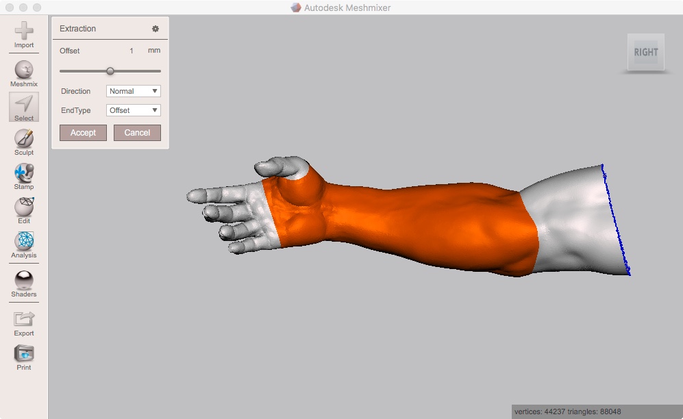 Solved: Creating various casts/splints for a 3d scanned right arm ...