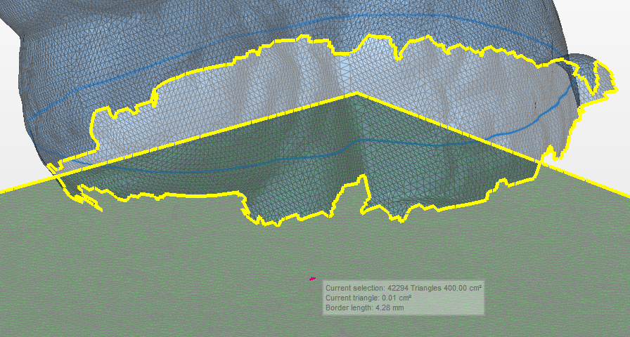 Adding a bottom surface to a 3d scan that lacks one - Autodesk Community